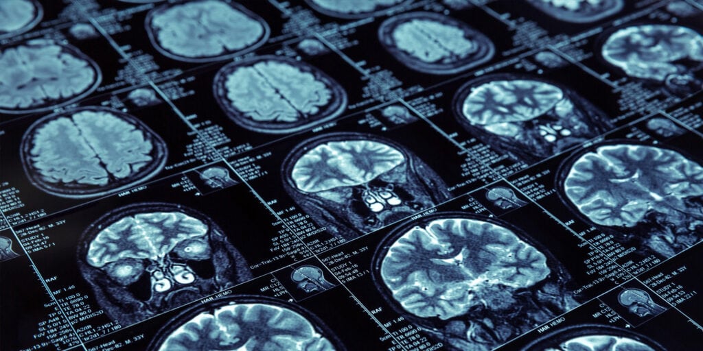 Concussion and Traumatic Head Injury - Spine and Joint Institute